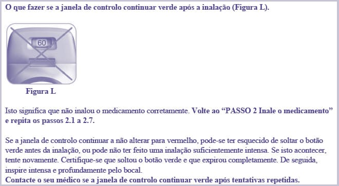 BRETARIS GENUAIR - Folheto Informativo